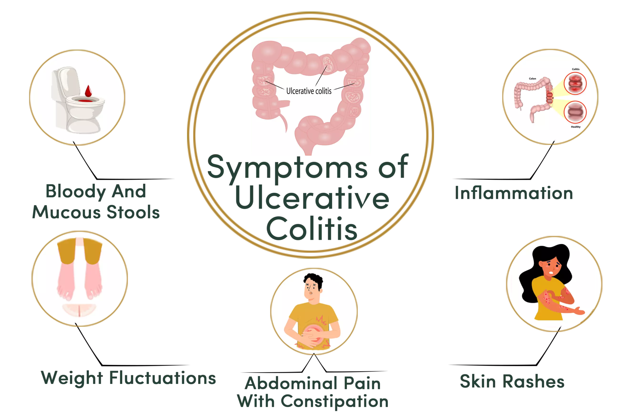 Ulcerative Colitis Ayurvedic Treatment - Durja Ayurveda
